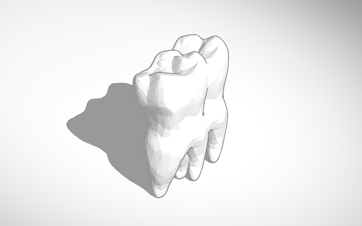 3D design Jayden's tooth - Tinkercad